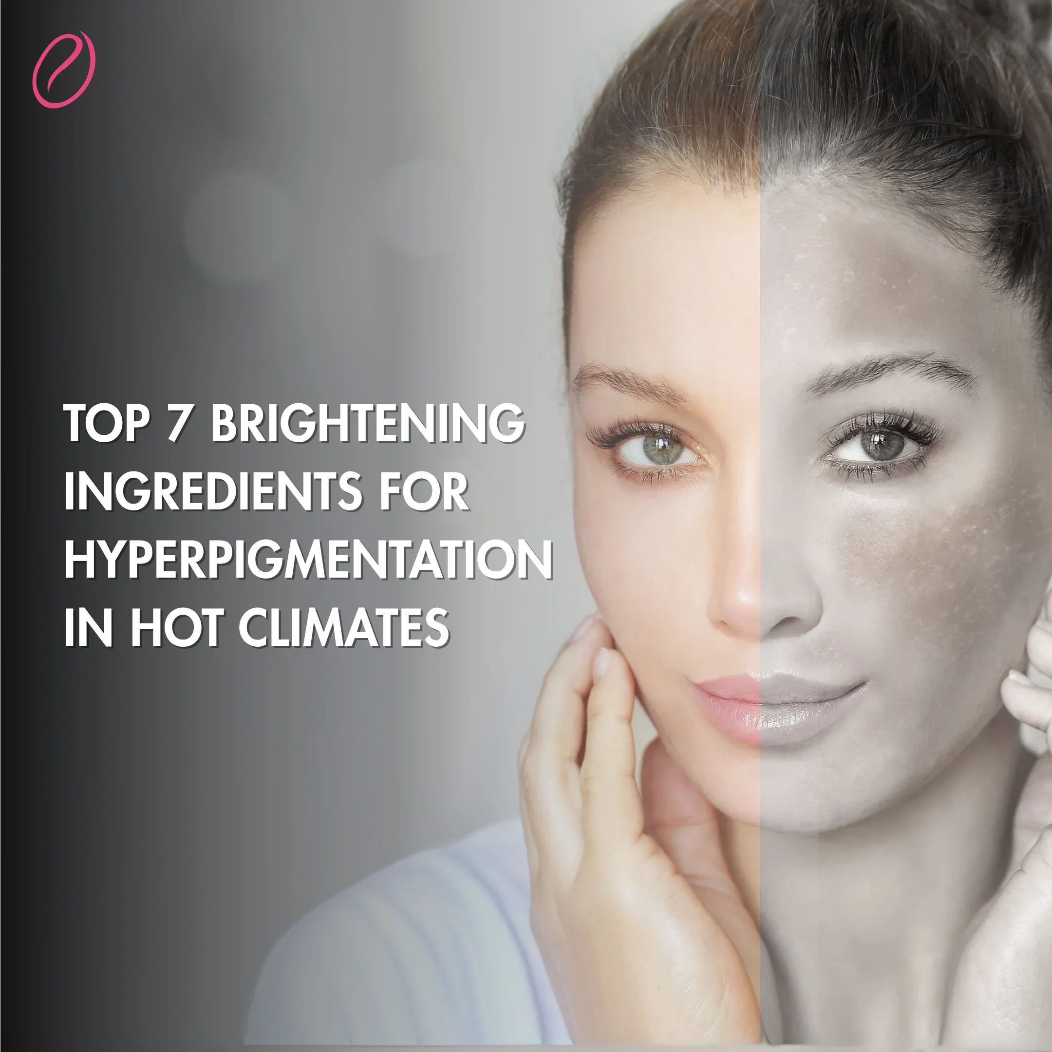 Best Ingredients for Hyperpigmentation in Hot Climates | 2025 Guide