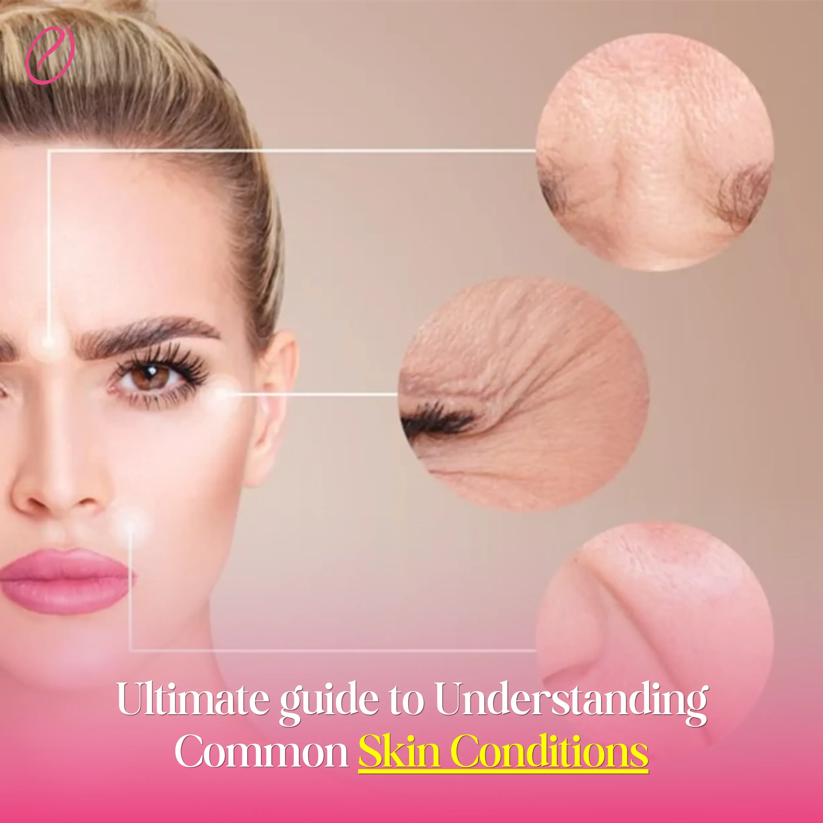 Understanding Common Skin Conditions; why is it importance